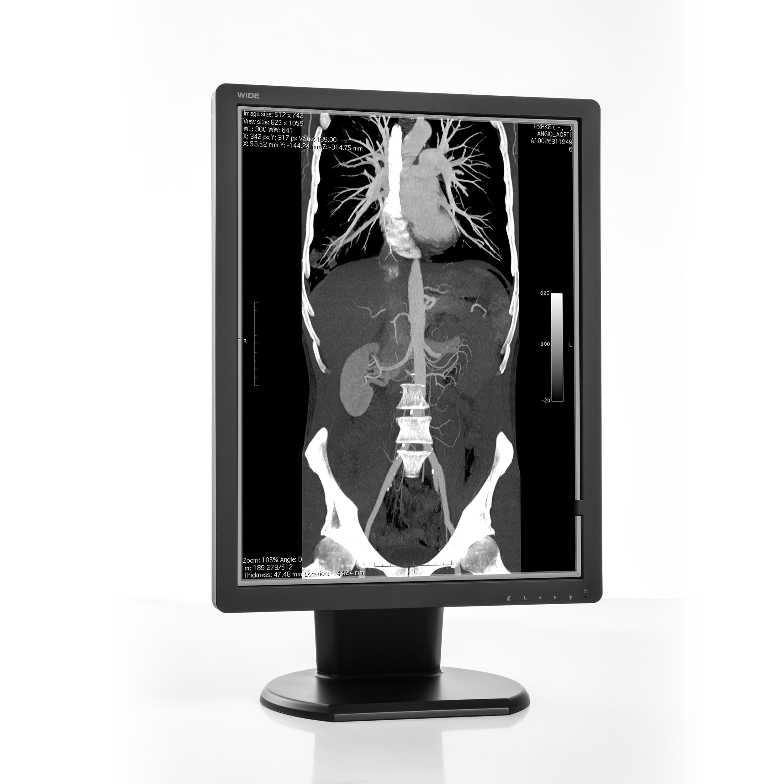 Diagnostic Displays - MX30N | MEDUTECH s.r.o.